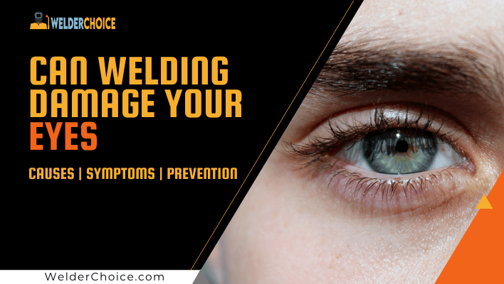Can Welding Damage Your Eyes Causes Symptoms Prevention Can Welding Damage Your Eyes Causes Symptoms Prevention